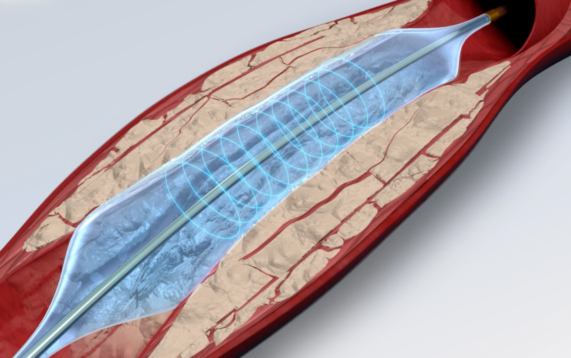 Home - AVS Pulse, Inc